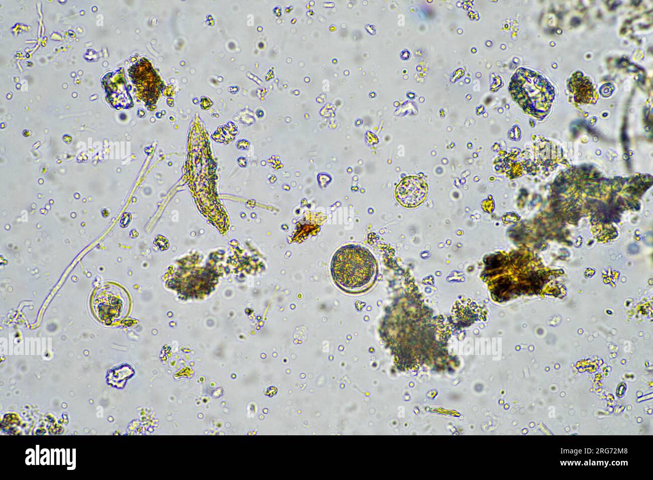 living soil life in a soil sample under the microscope in a lab Stock ...