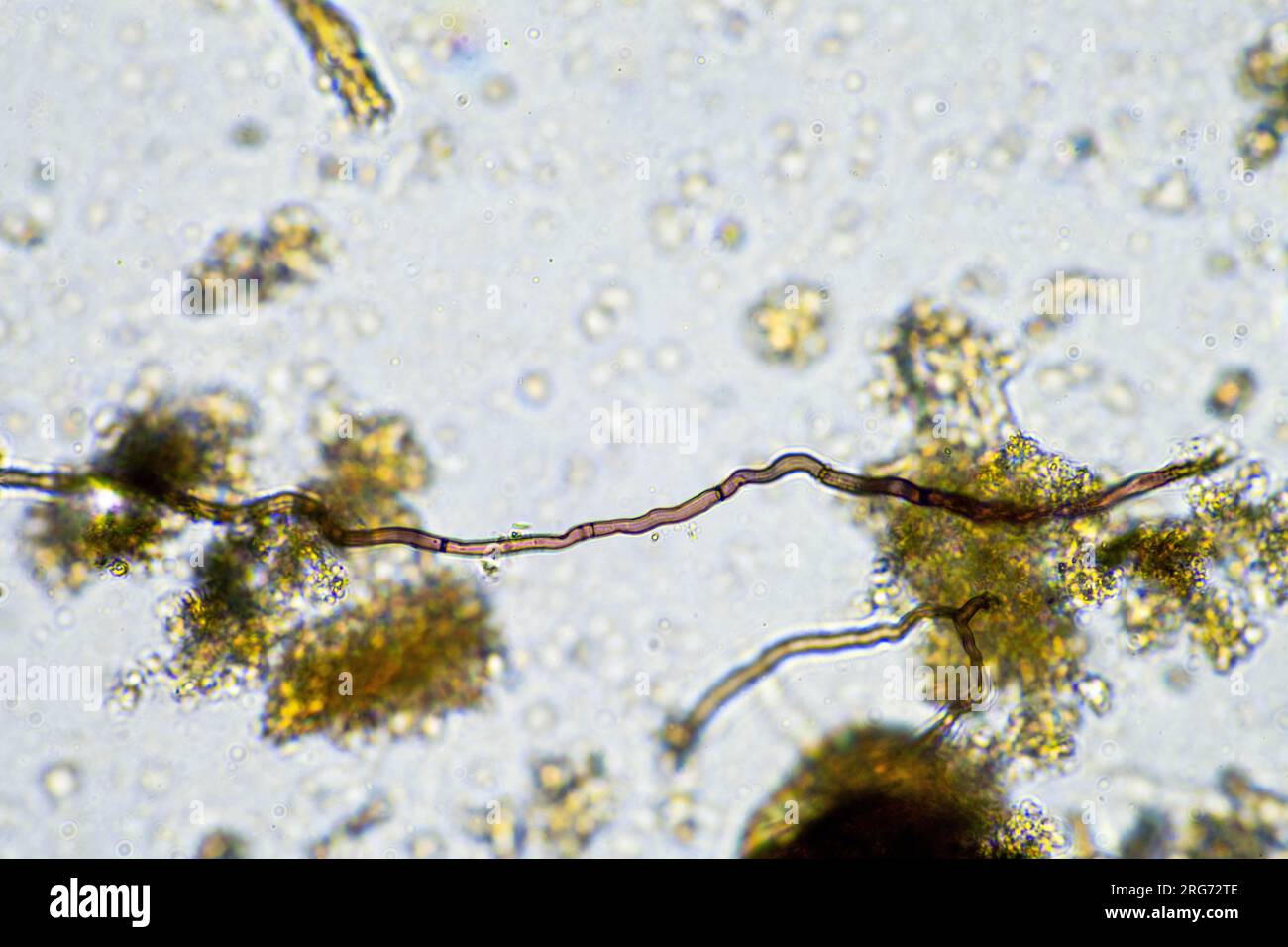 fungal hyphae on a soil sample on a farm. fungi storing carbon in the ...