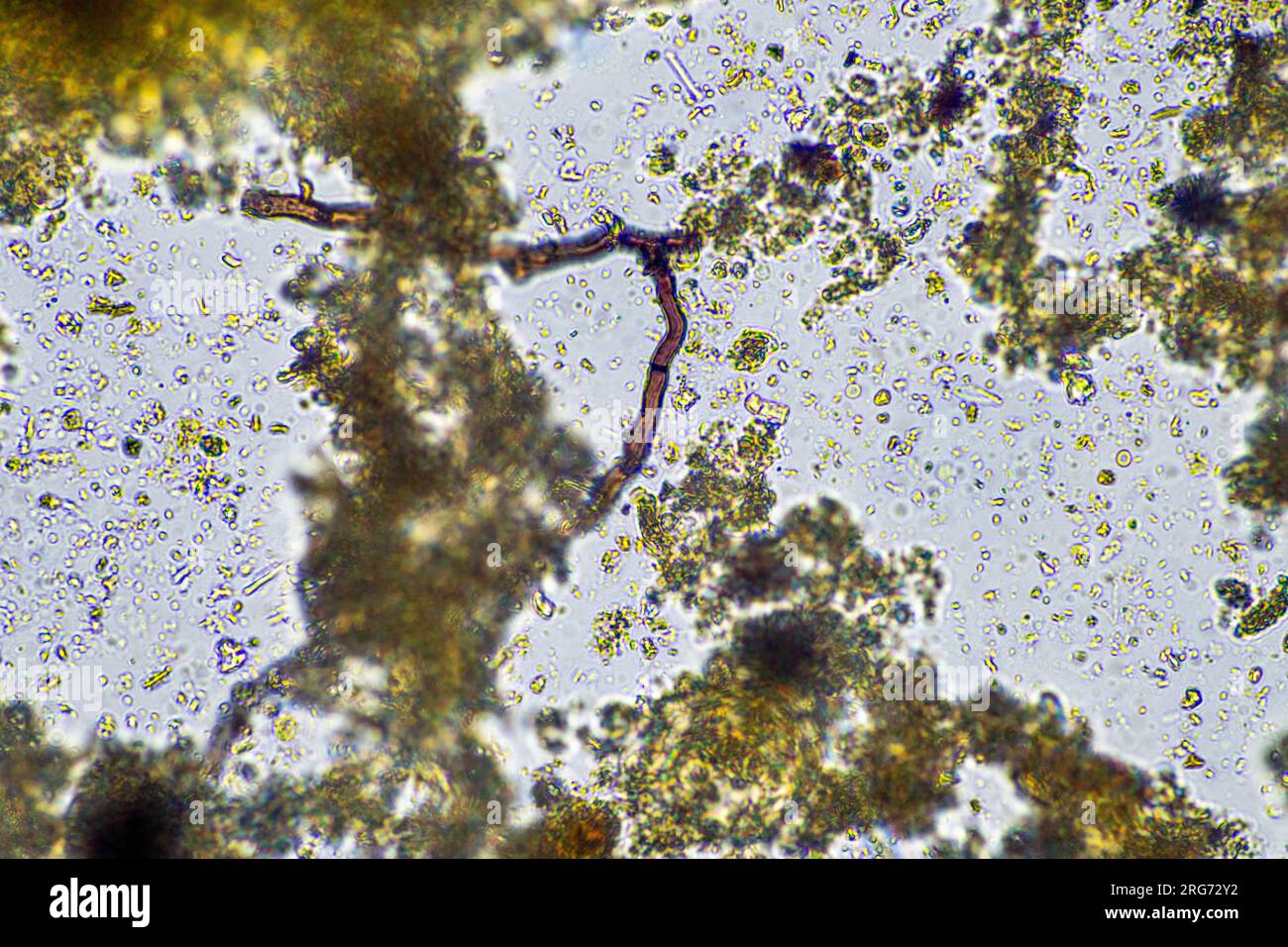 fungal hyphae on a soil sample on a farm. fungi storing carbon in the ...