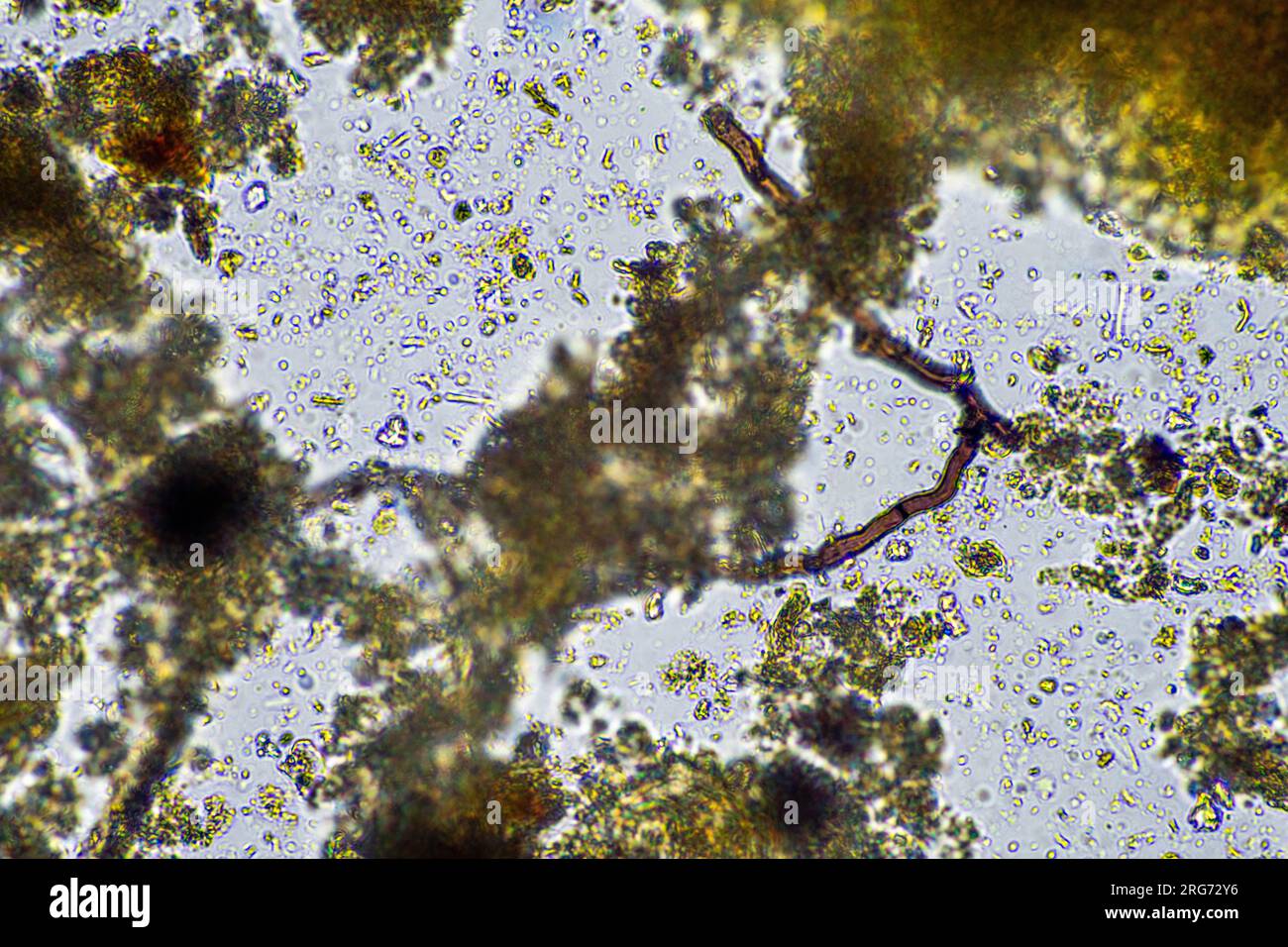 fungal hyphae on a soil sample on a farm. fungi storing carbon in the ...
