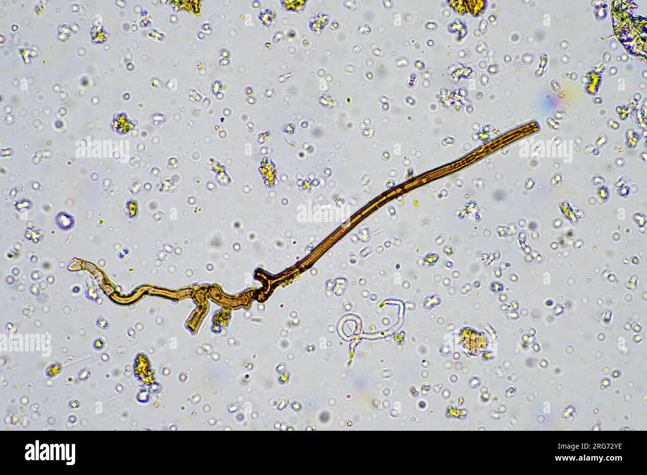 fungal hyphae on a soil sample on a farm. fungi storing carbon in the ...
