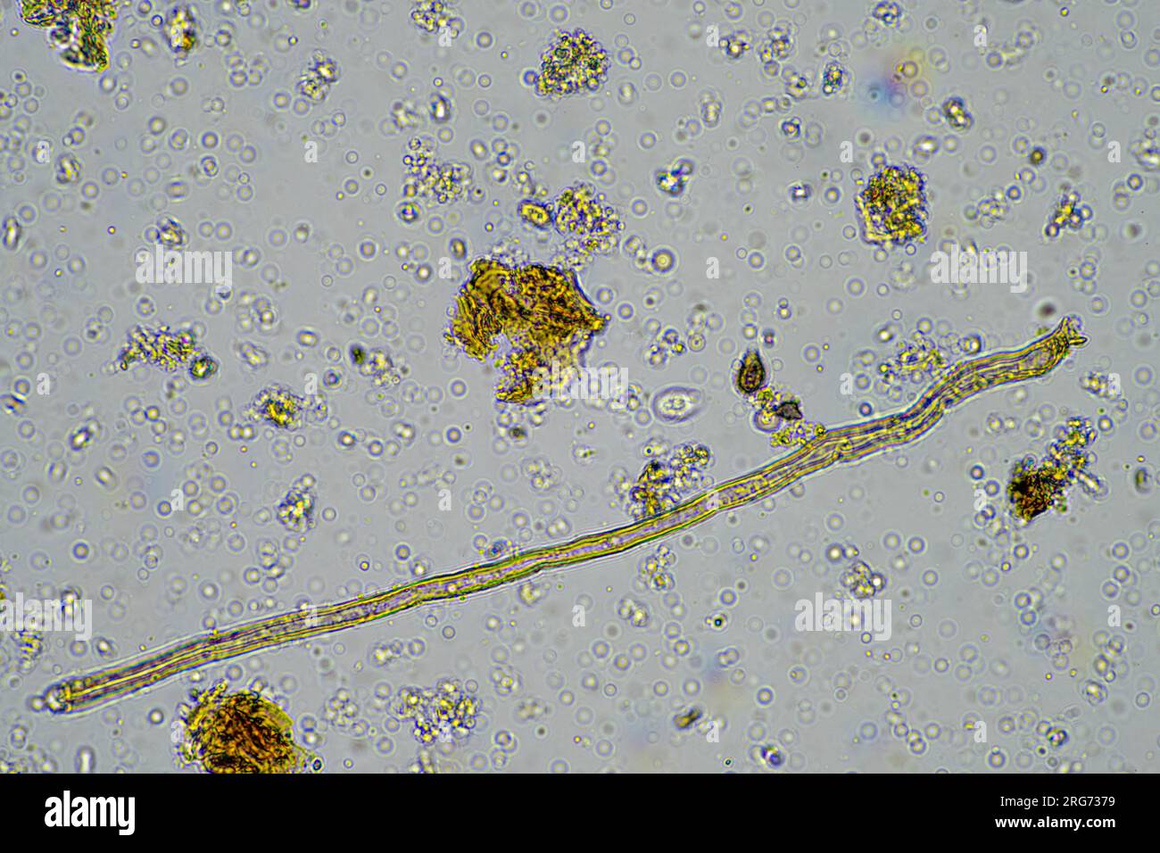 plant cellulose in a soil sample under the microscope on a farm Stock ...
