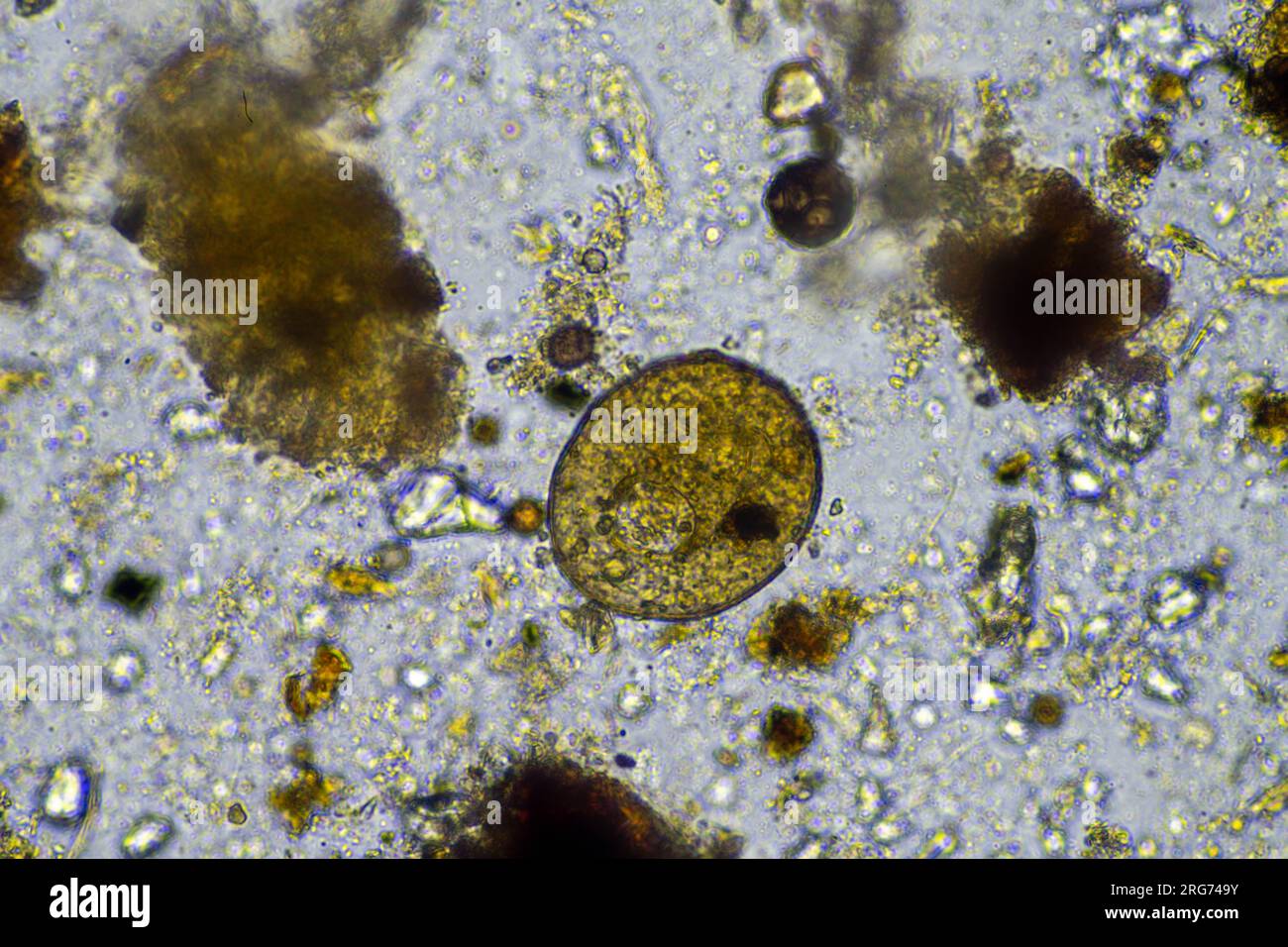 arcella in a tissue sample in a lab Stock Photo - Alamy