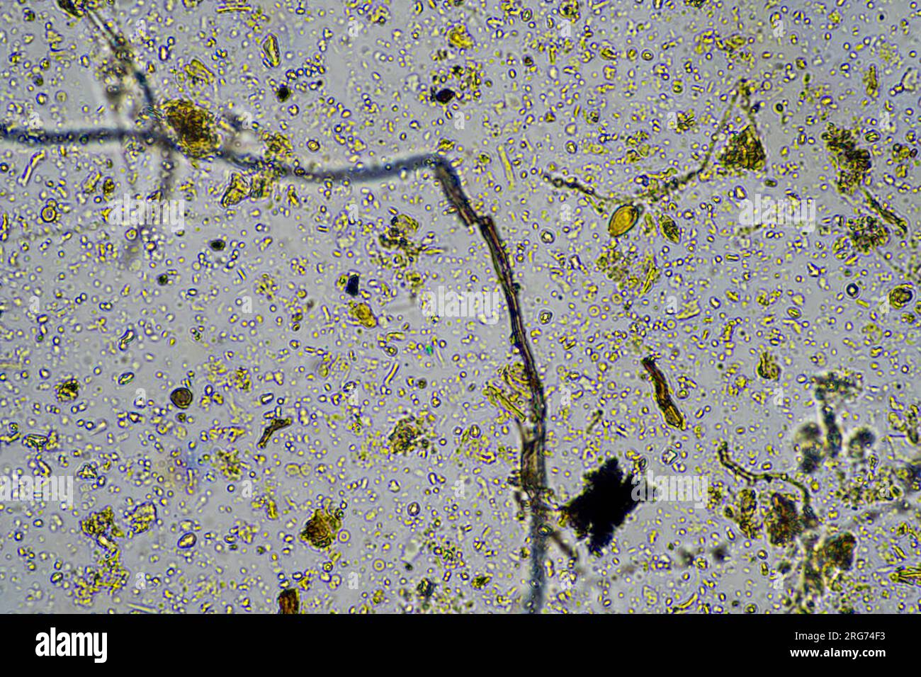 fungal hyphae on a soil sample on a farm. fungi storing carbon in the ...