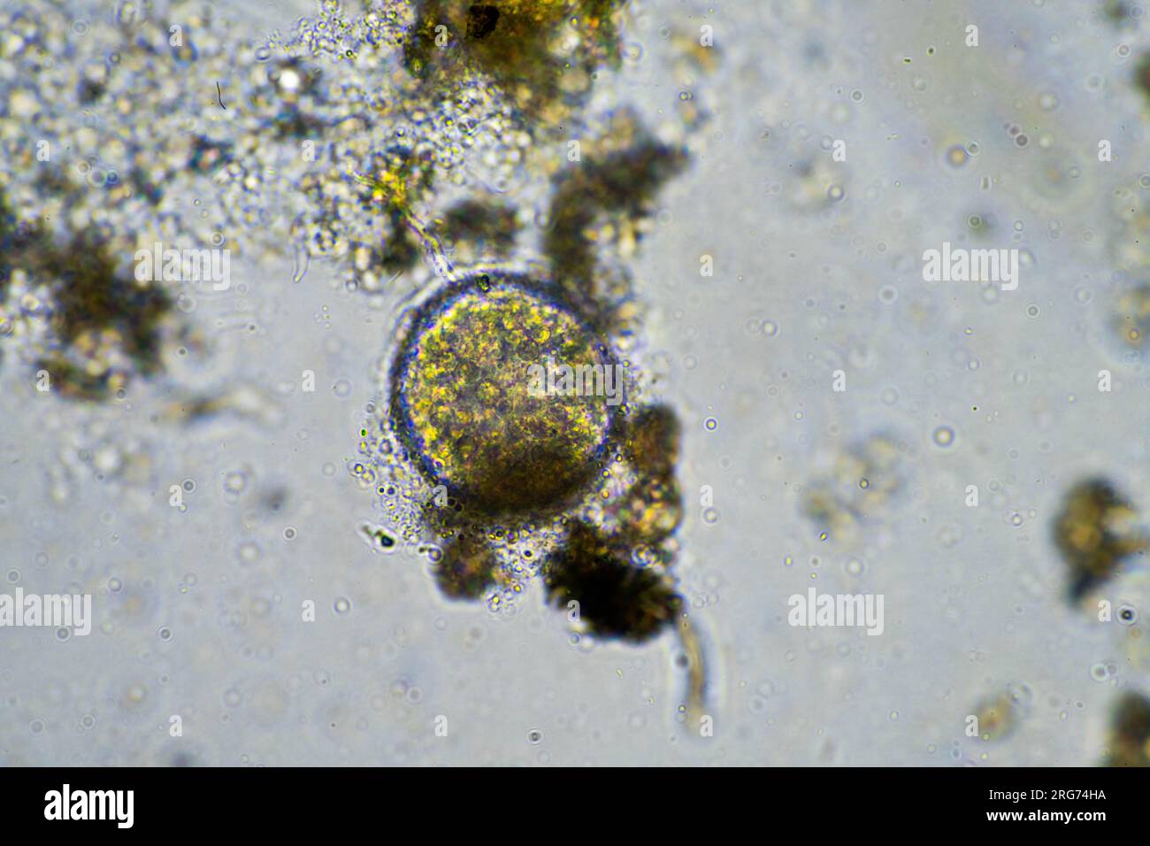 Spore sample hi-res stock photography and images - Alamy