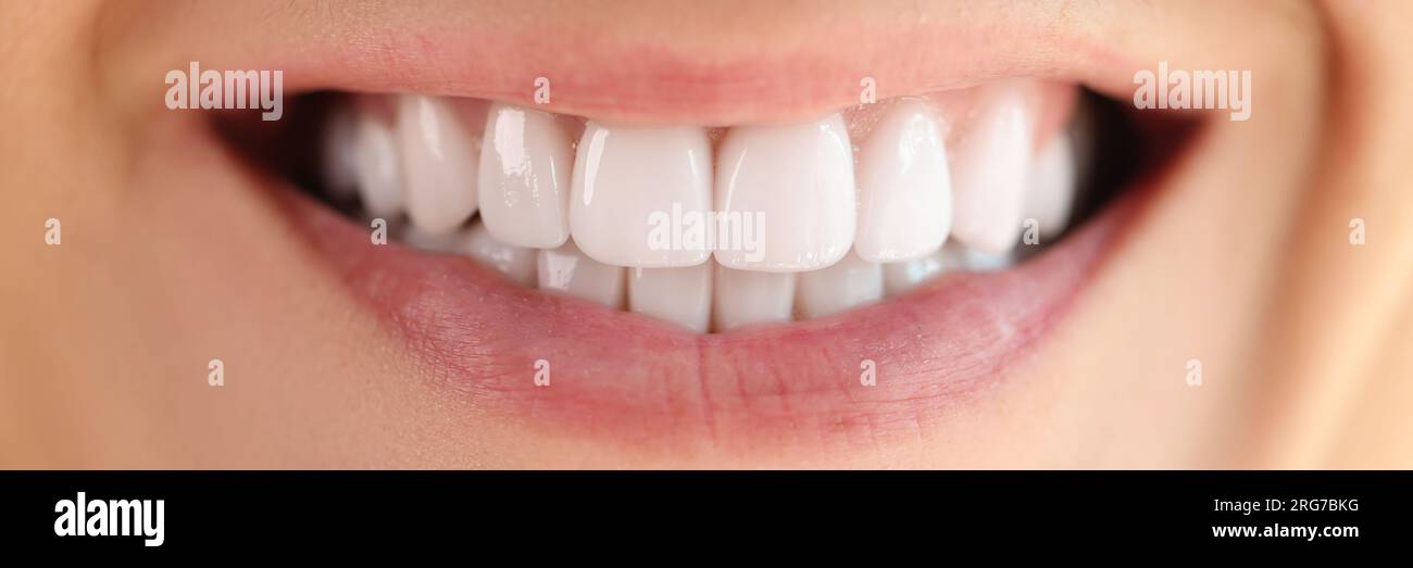 Close-up of healthy smooth white teeth smile Stock Photo - Alamy