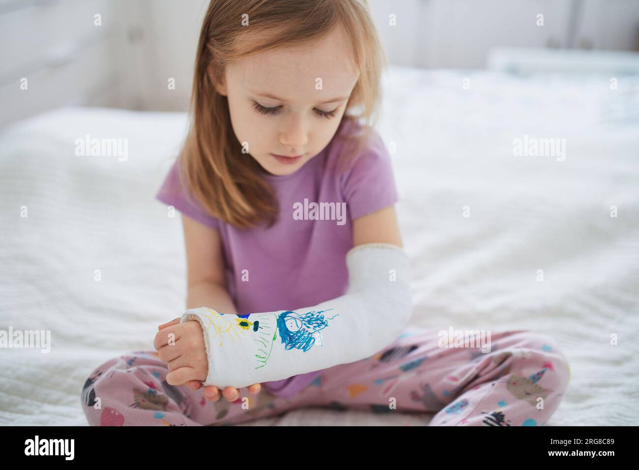 Adorable preschooler girl with a broken arm at home on the bed draws ...