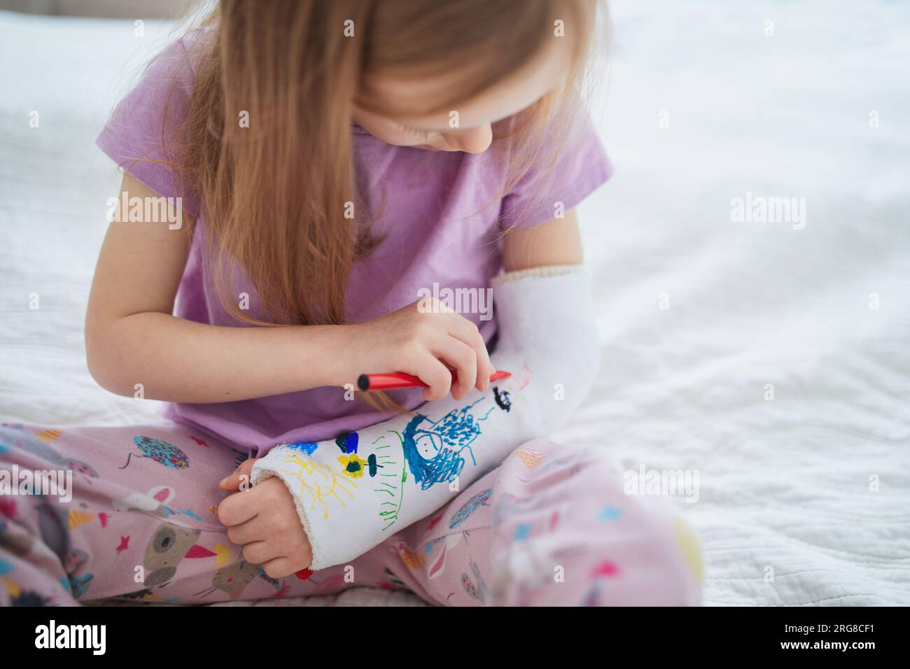 Adorable preschooler girl with a broken arm at home on the bed draws ...