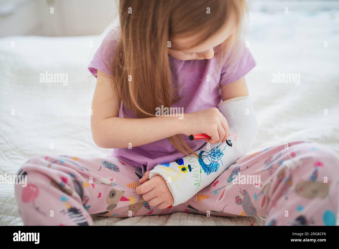 Adorable preschooler girl with a broken arm at home on the bed draws ...