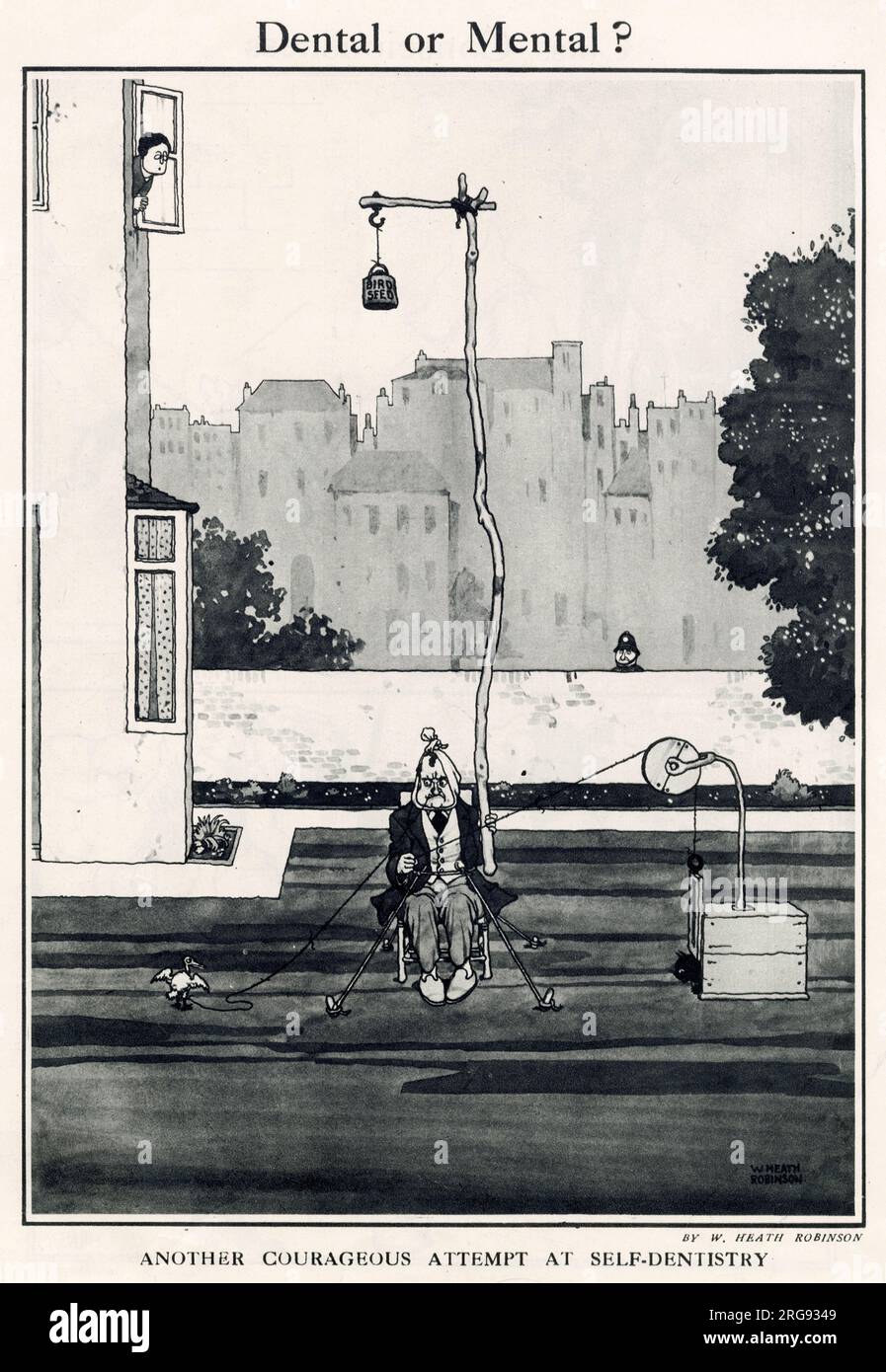 A suggested method of tooth-extraction with a primitive contraption ...