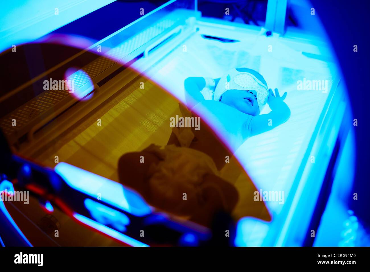 Newborn baby girl receiving phototherapy for jaundice at the maternity ...