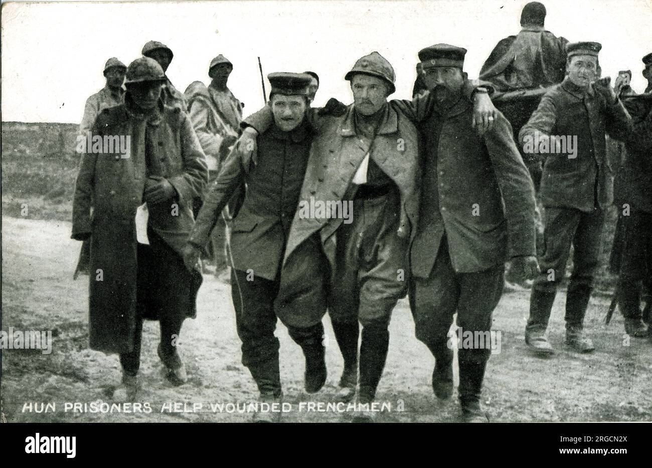 German prisoners help wounded Frenchmen, WW1 Stock Photo - Alamy