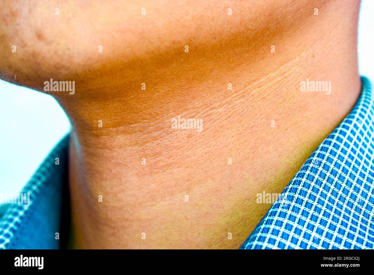 Fat folds hi-res stock photography and images - Alamy