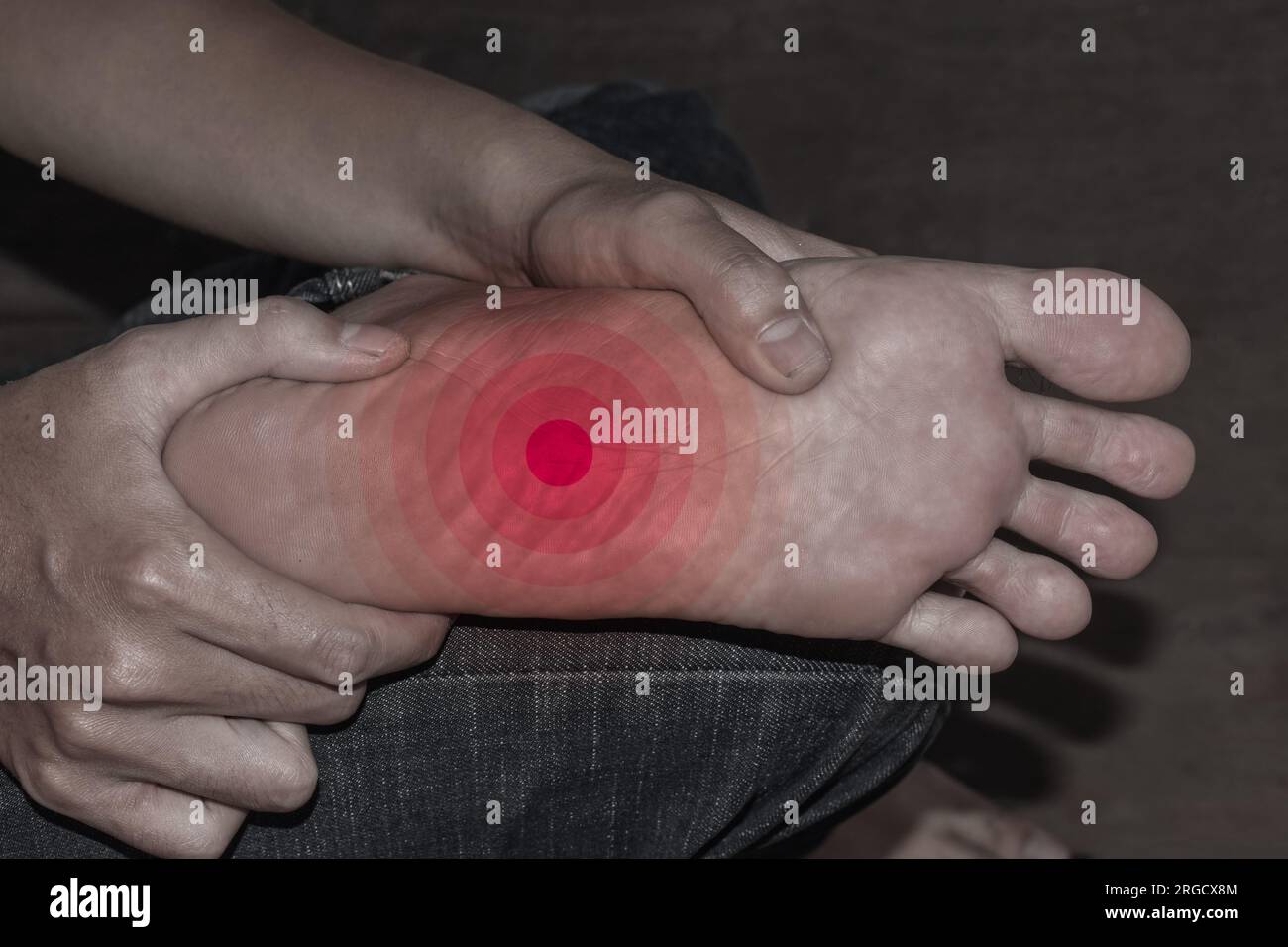 Plantar Foot Cellulitis at Lily Mueller blog