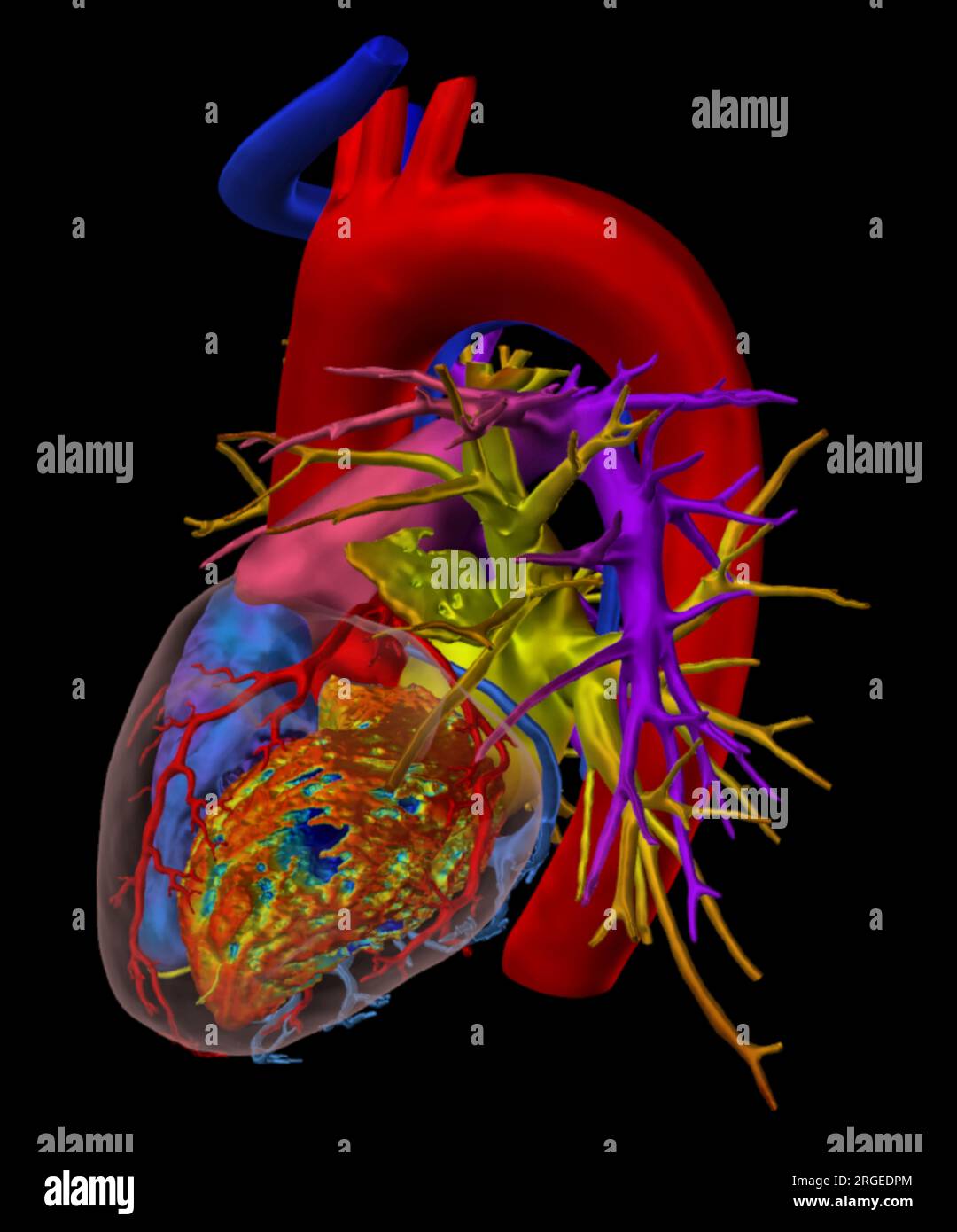 Healthy heart, 3D CT scan Stock Photo - Alamy