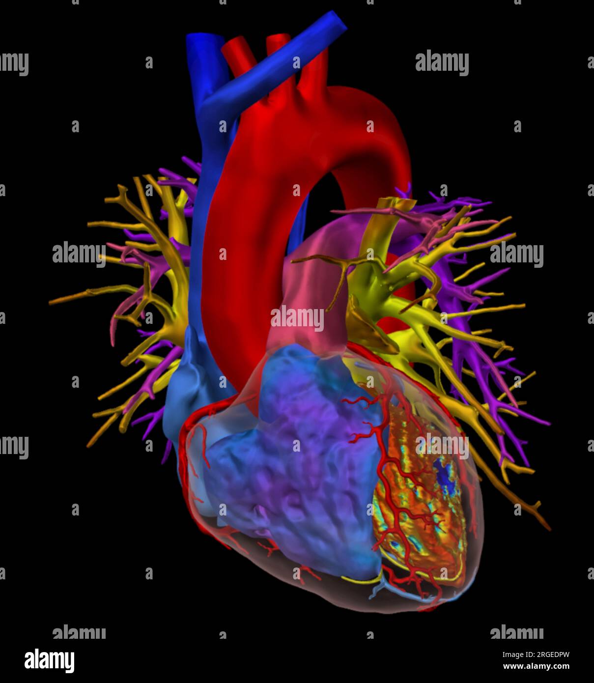 Healthy heart, 3D CT scan Stock Photo - Alamy