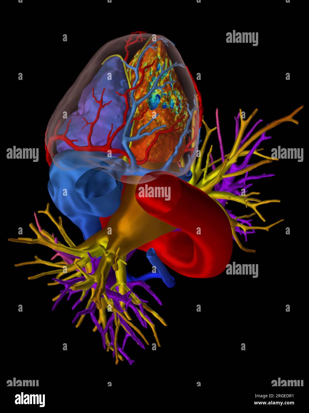 Healthy heart, 3D CT scan Stock Photo - Alamy