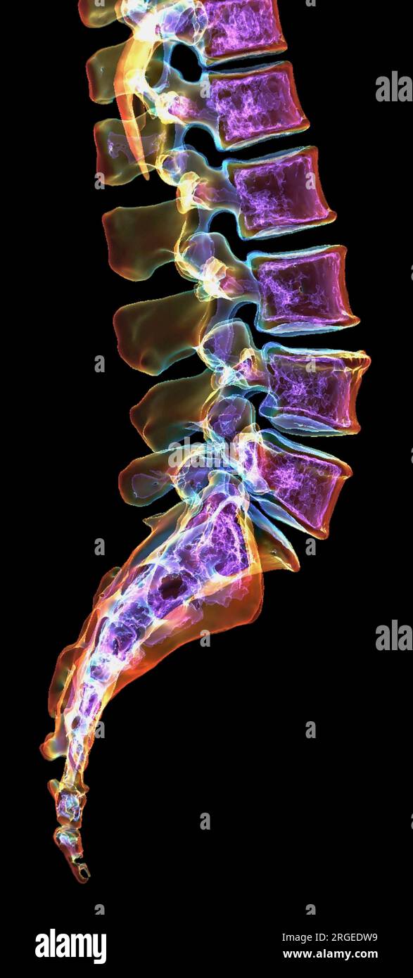 Lumbar and sacral spine, 3D CT scan Stock Photo - Alamy