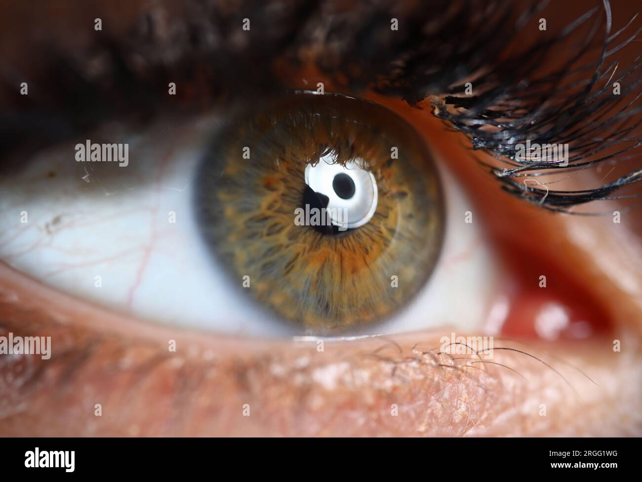 Cataract female eye closeup ophthalmology hi-res stock photography and ...