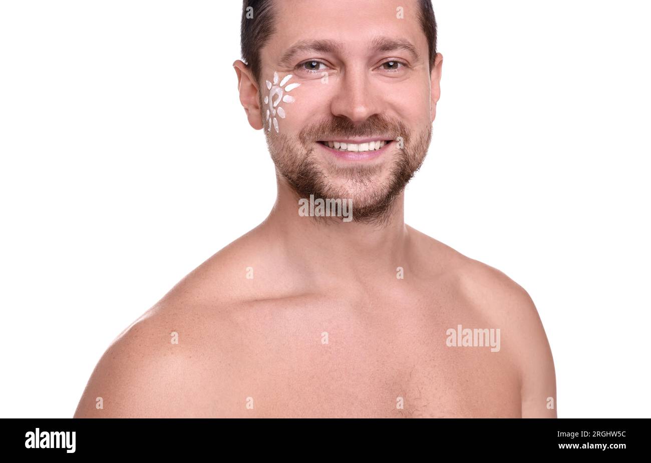 Man sunburn face hi-res stock photography and images - Alamy