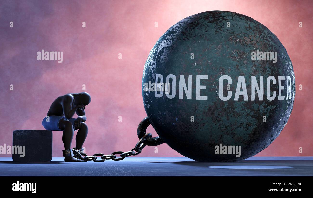 Bone cancer - a metaphor showing human struggle with Bone cancer ...