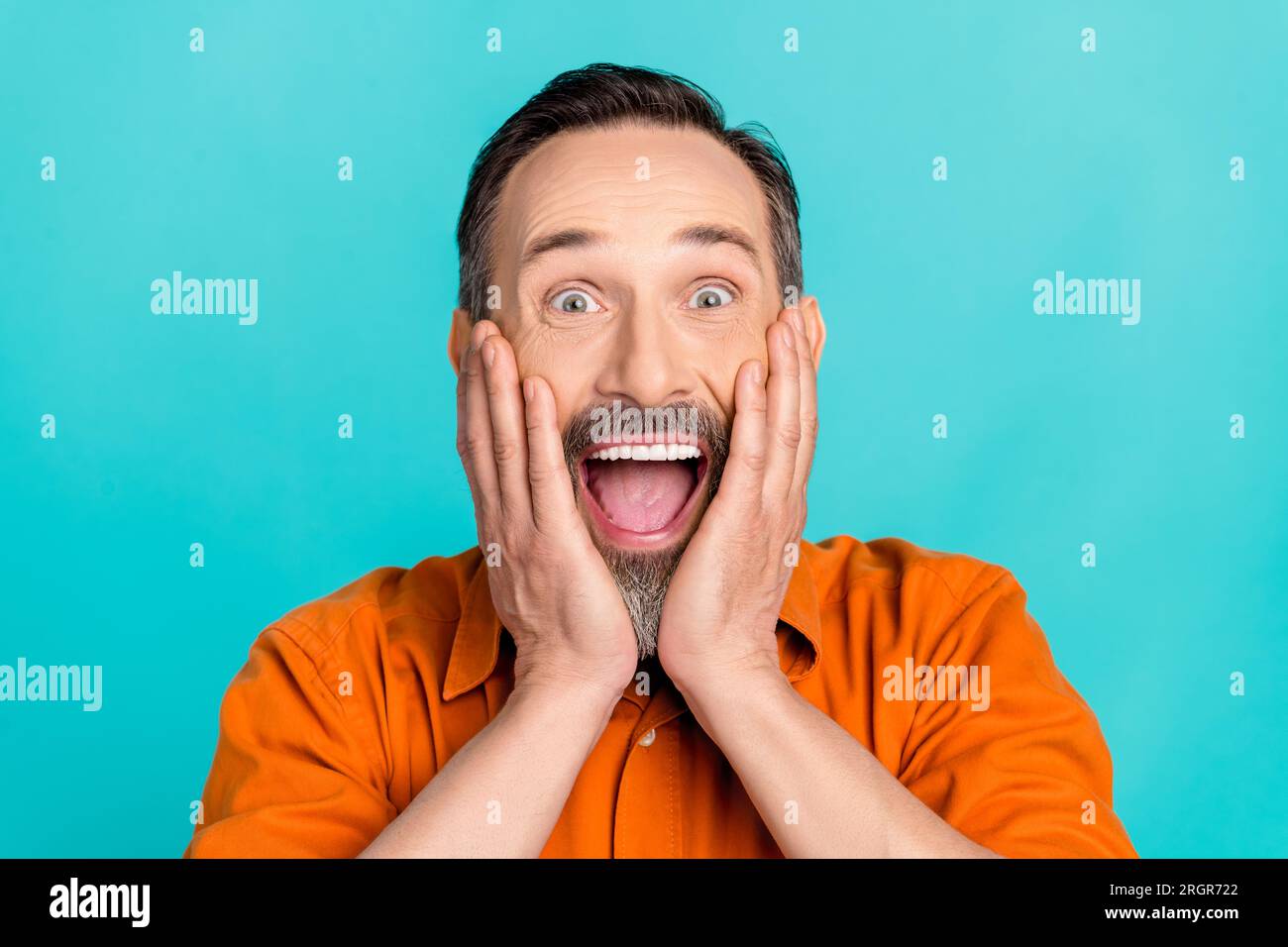 Photo Of Funny Impressed Guy Wear Orange Shirt Arms Cheeks Open Mouth