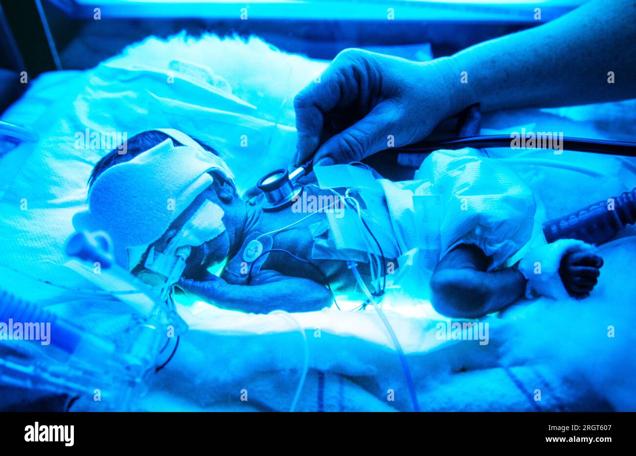 A neonatal intensive care hospital doctor monitors a tiny premature ...