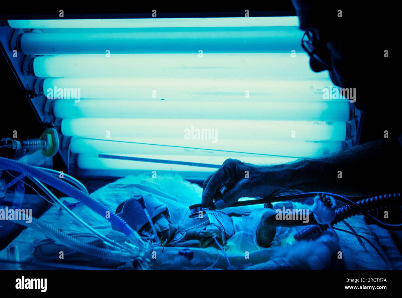 A neonatal intensive care hospital doctor monitors a tiny premature ...