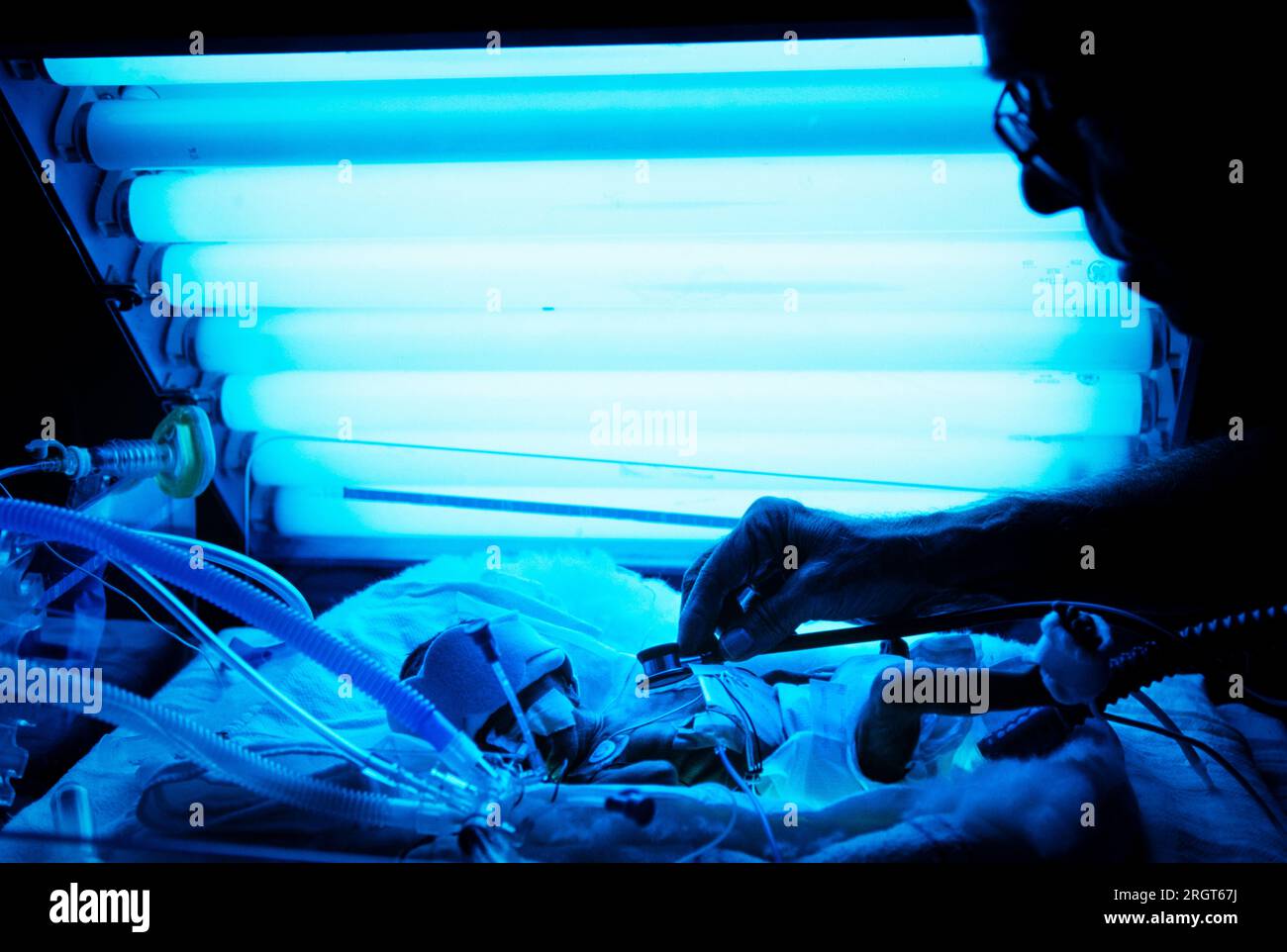 A neonatal intensive care hospital doctor monitors a tiny premature ...