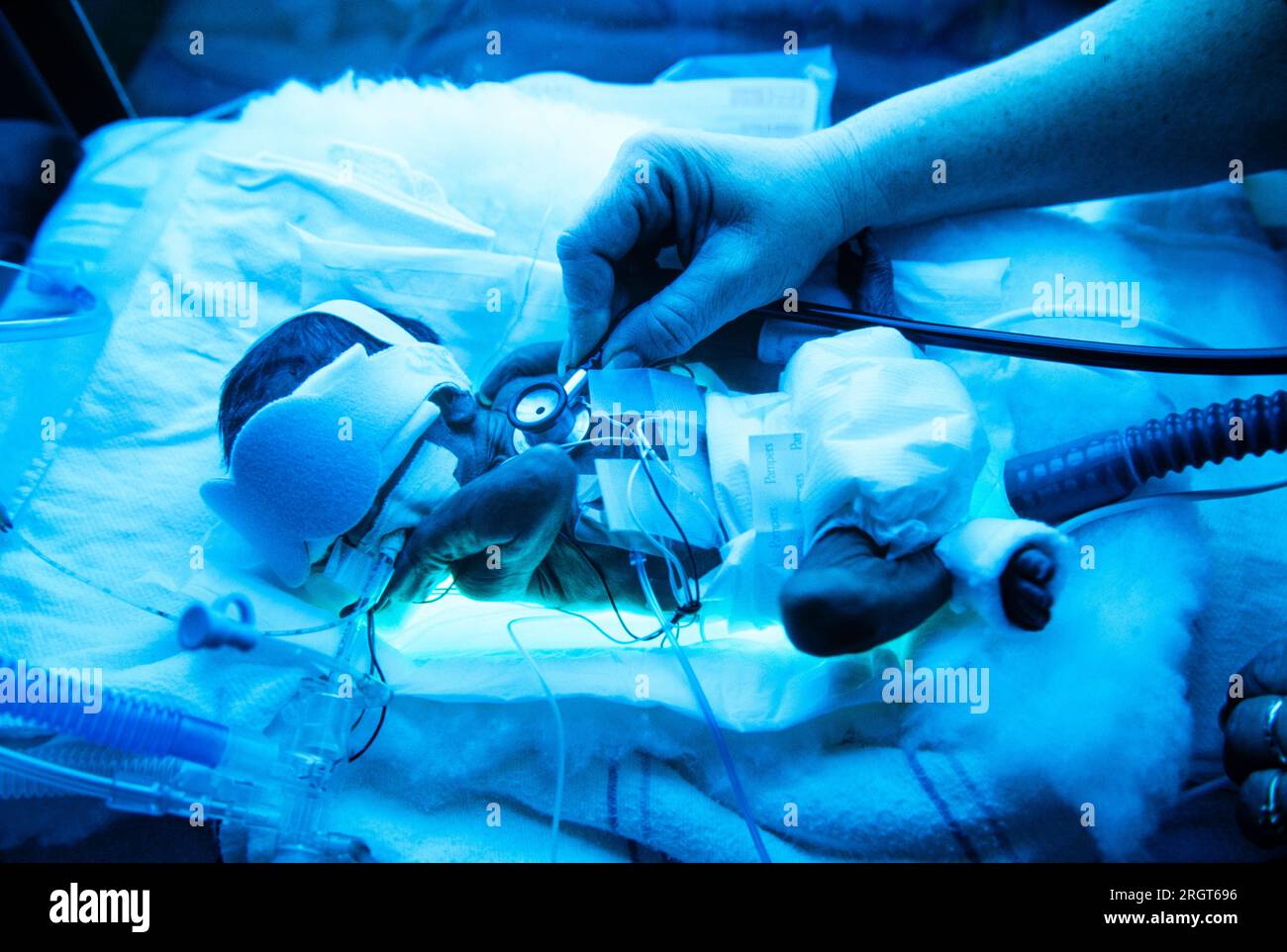 A neonatal intensive care hospital doctor monitors a tiny premature ...