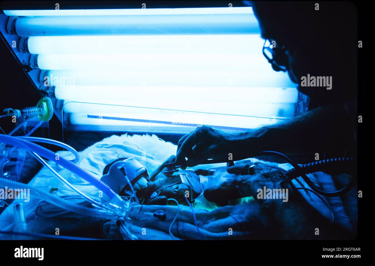 A neonatal intensive care hospital doctor monitors a tiny premature ...