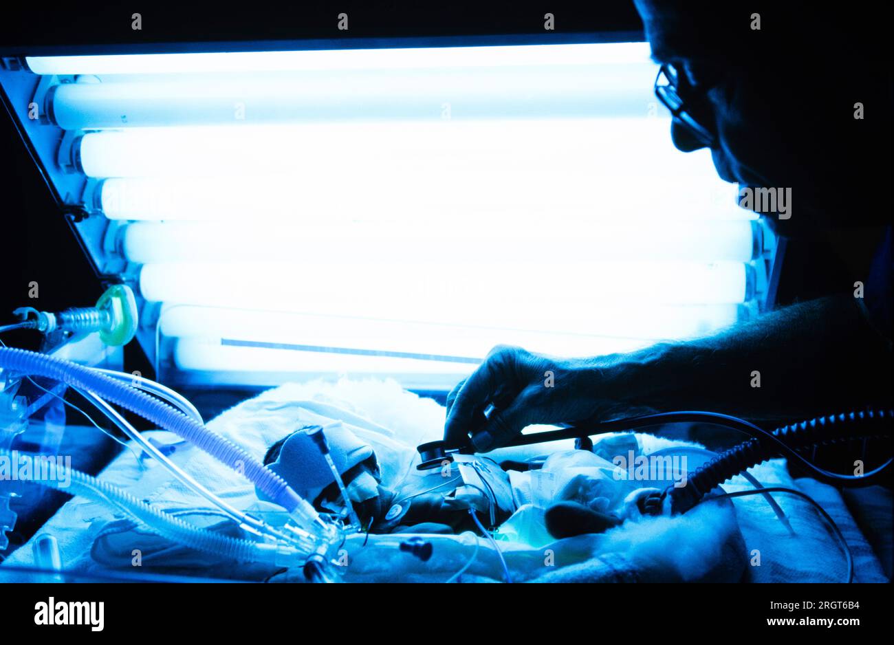 A neonatal intensive care hospital doctor monitors a tiny premature ...