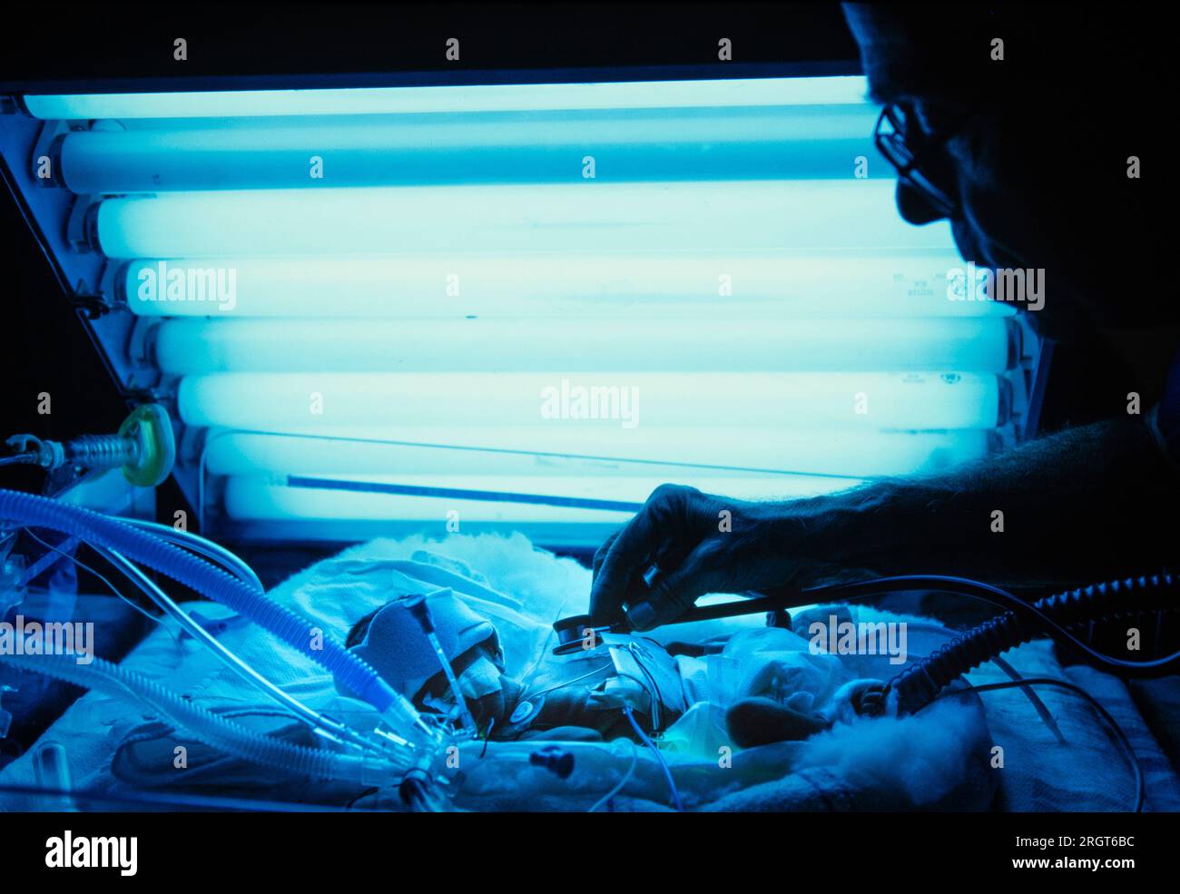 A neonatal intensive care hospital doctor monitors a tiny premature ...