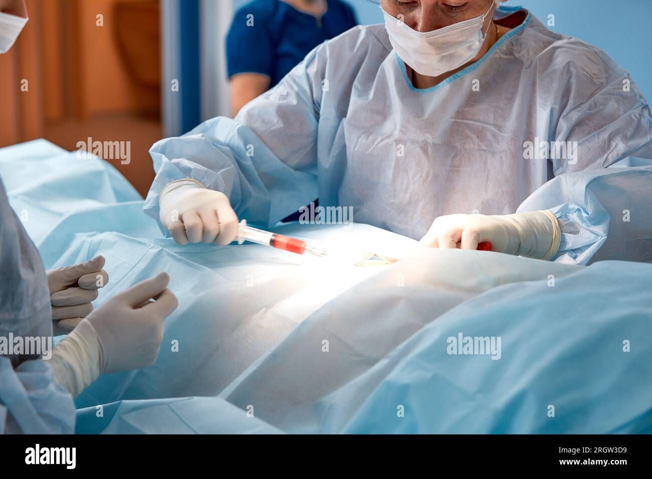 Perspective of a patient on a operating table who sees the doctor above ...