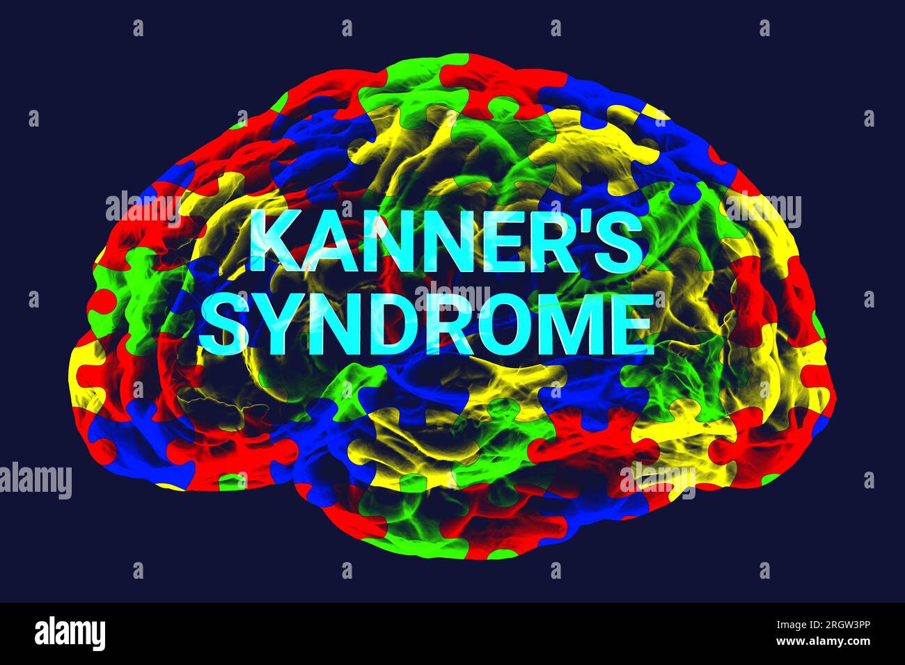 Kanner's syndrome, conceptual illustration Stock Photo - Alamy