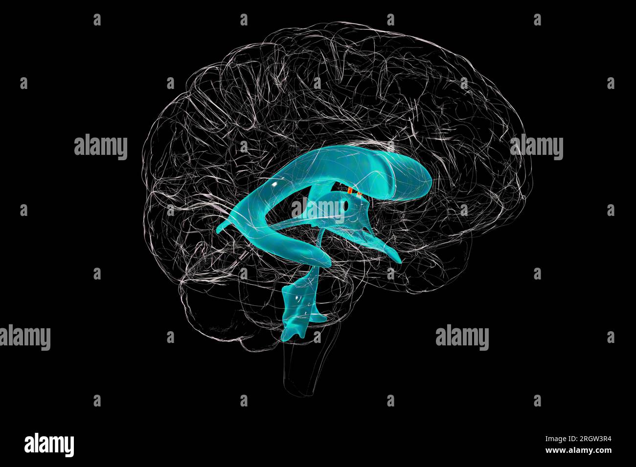 Interventricular foramen, illustration Stock Photo - Alamy