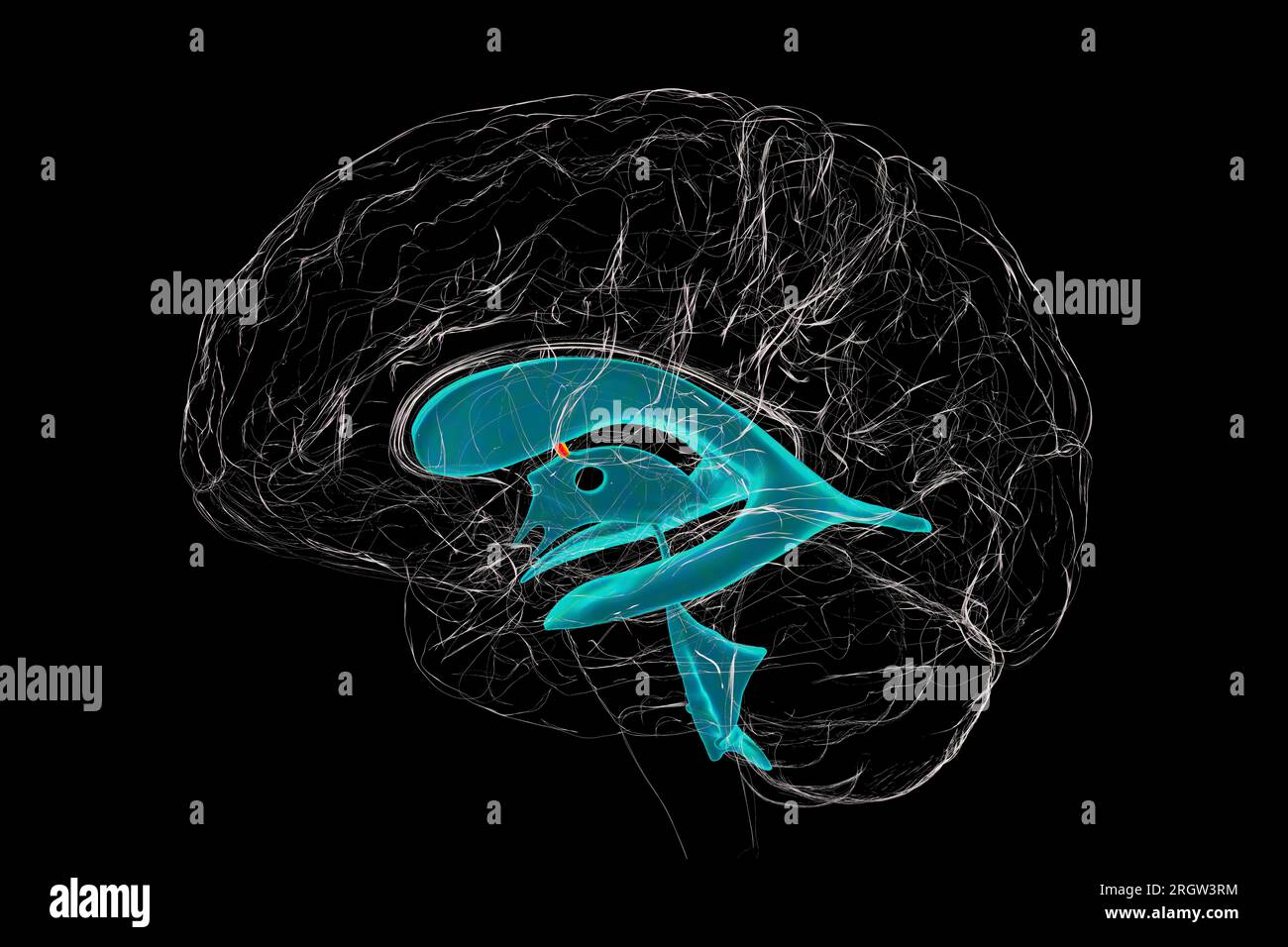 Interventricular foramen, illustration Stock Photo - Alamy