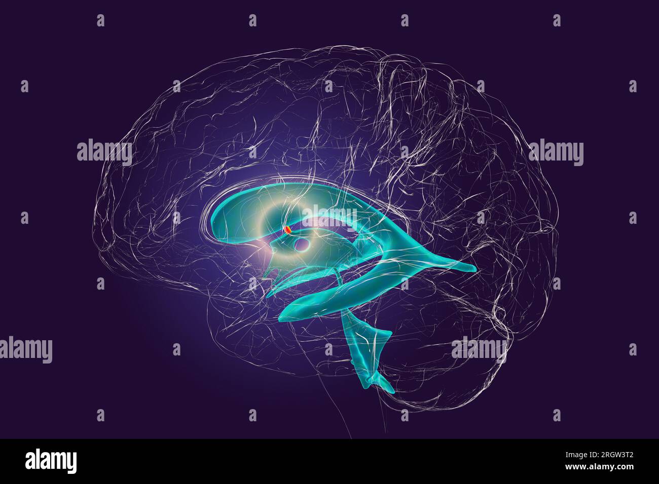 Interventricular foramen, illustration Stock Photo - Alamy