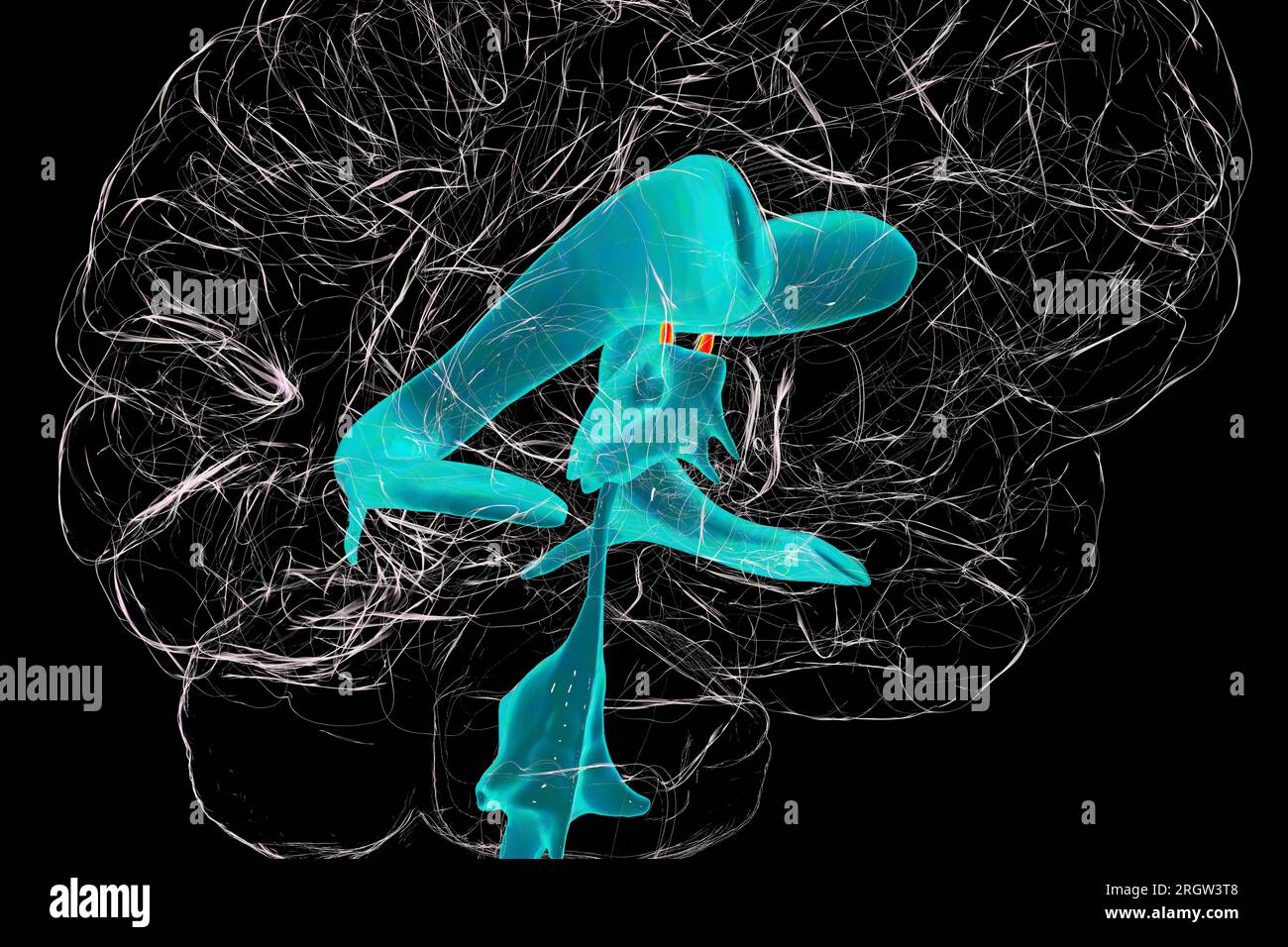 Interventricular foramen, illustration Stock Photo - Alamy