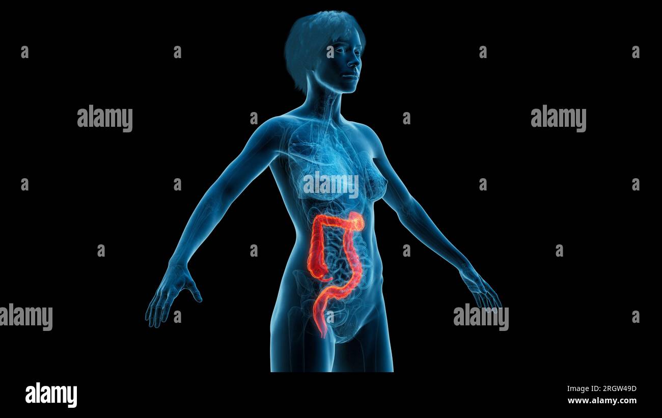 Normal appendix illustration hi-res stock photography and images - Alamy