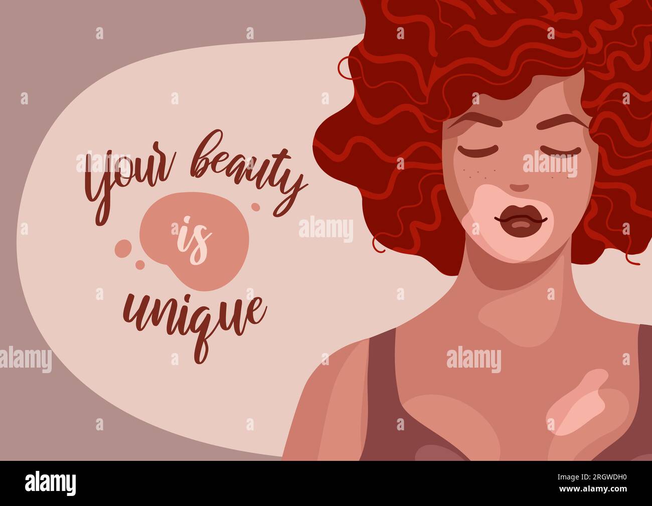 Beautiful redhead woman, vitiligo on bright skin and wavy curly hair ...