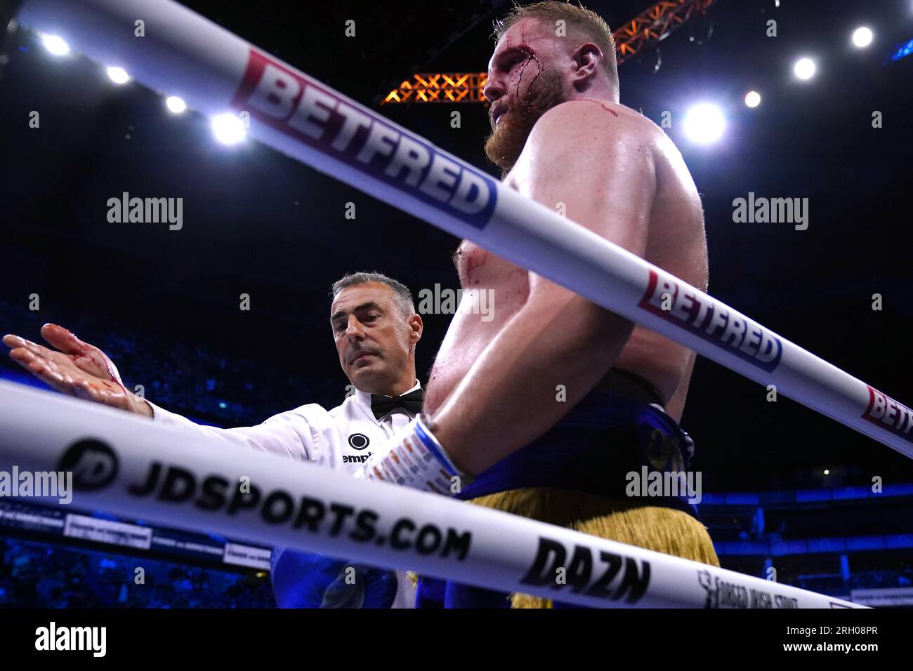 Harry Armstrong looks on as blood falls from his face as the ring ...