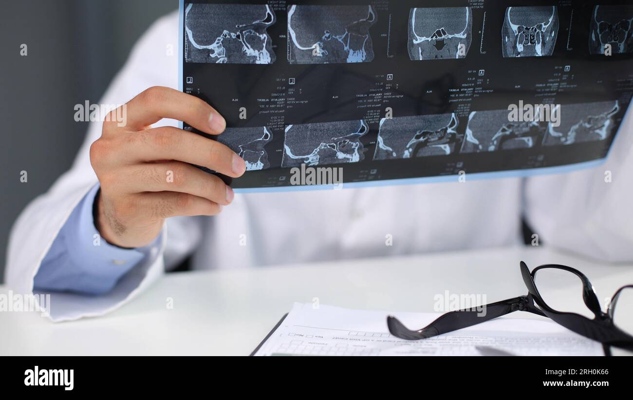 Human head mri brain scan what do they look for hi-res stock ...