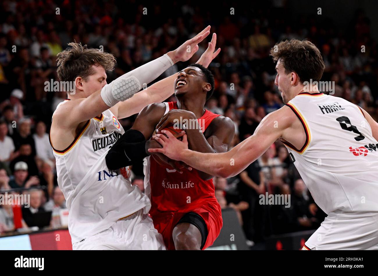 Harlequin Ichthyosis Ryan Gonzalez