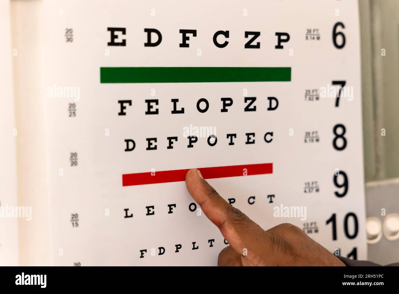 NGO charity work african village specialist eye test for the villagers ...