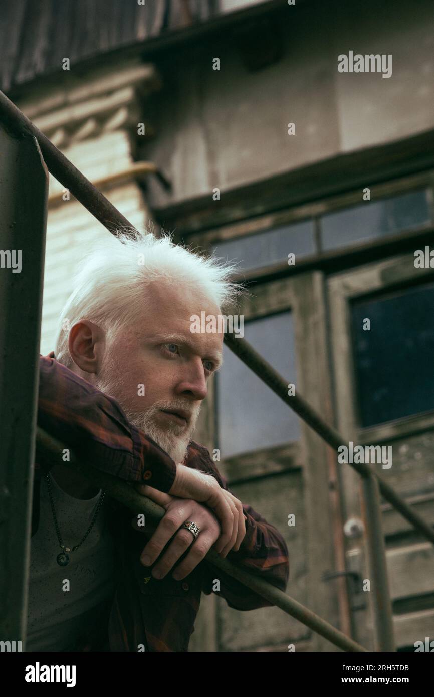 Albino man leaned on the fence against the background of the house ...