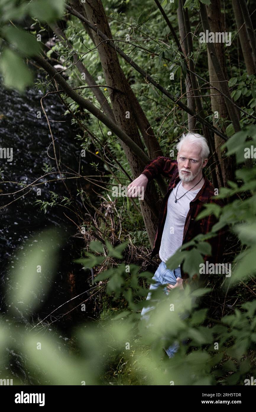 Albino model male hi-res stock photography and images - Alamy