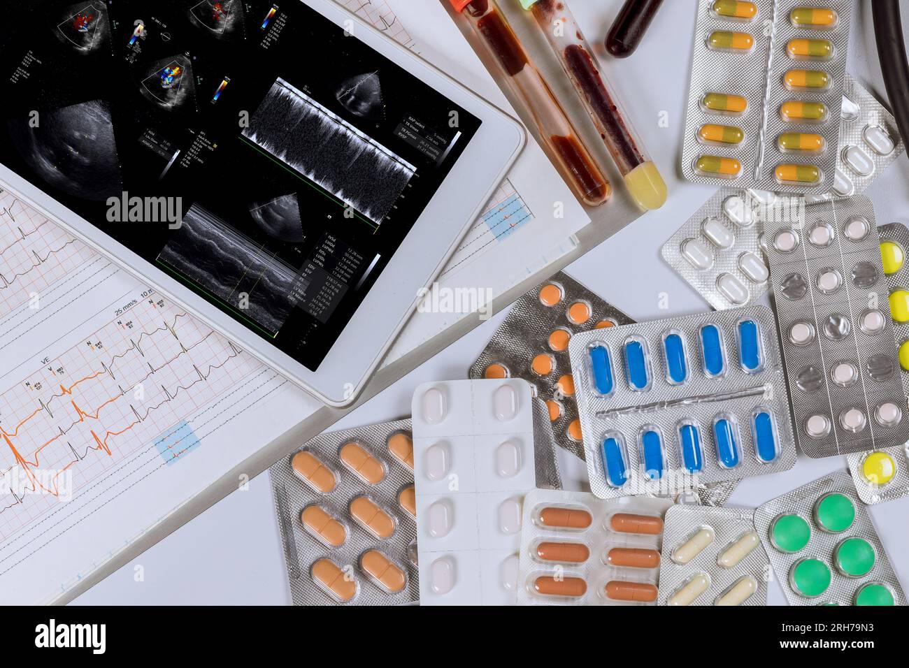 Through digital tablet doctor is performing ultrasound echocardiography ...