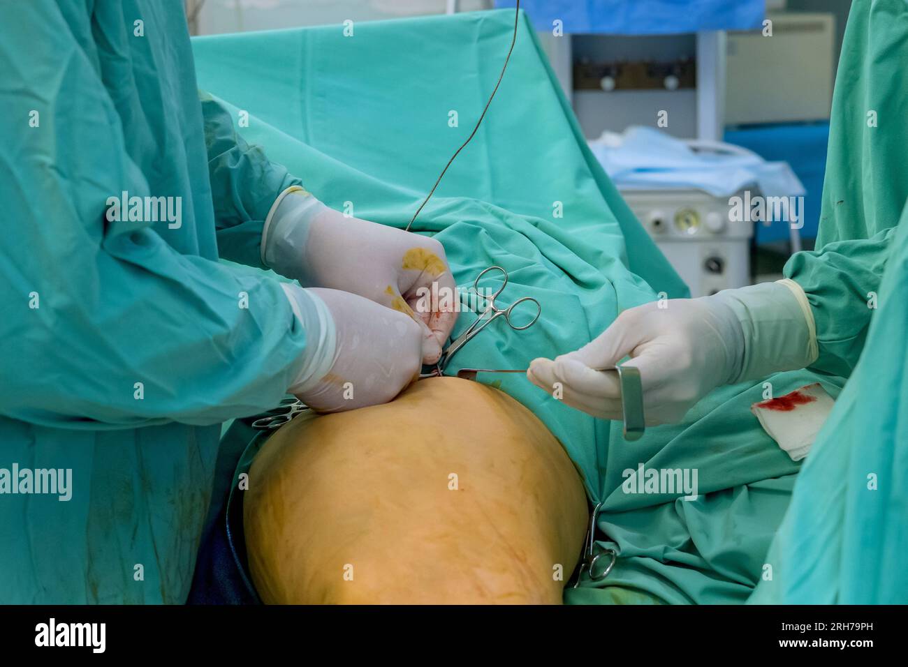 Leg surgeries performed by orthopedic specialists are used to address a ...