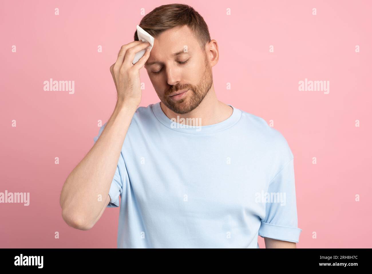 Overheat tired man puts wet wipe on head sweating feeling unhealthy ...